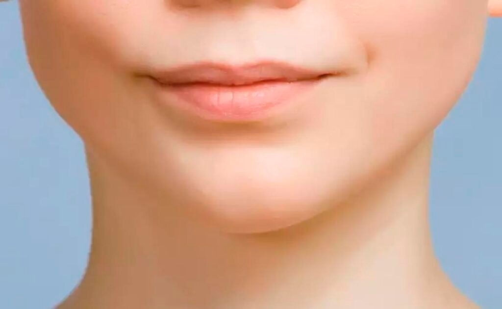 Guía Completa: Aumento de Mentón con Prótesis